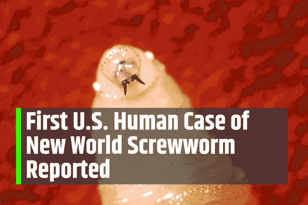 First U.S. Human Case of New World Screwworm Reported